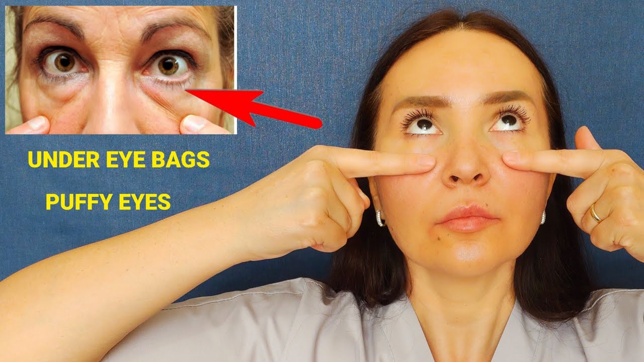 Massage for UNDER EYE BAGS, Puffy eyes, dark circles, swollen eyes - YouTube