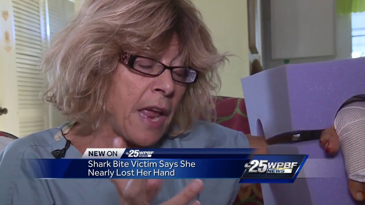Shark bite victim says she nearly lost her hand - YouTube