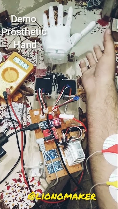 EMG Based Robotic Prosthetic Hand | Demo Experiment | Liono Maker - YouTube