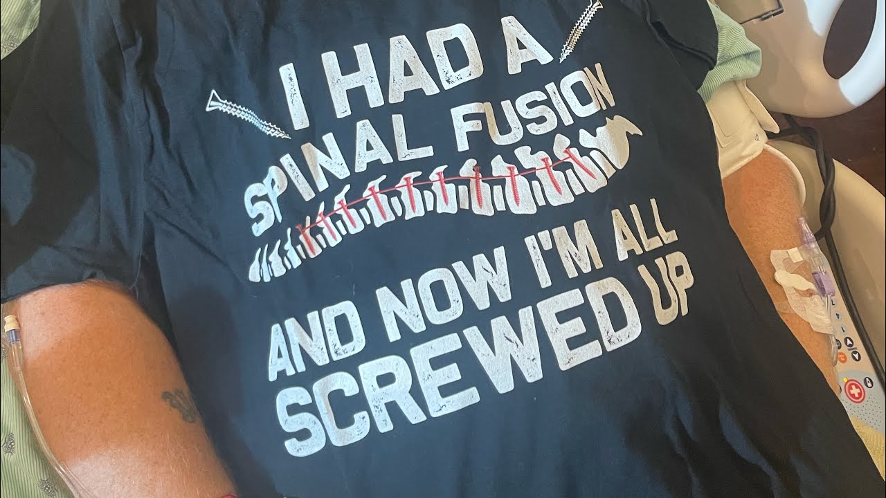 360 Spinal Fusion at L5 S1 ALIF/ PLIF - YouTube