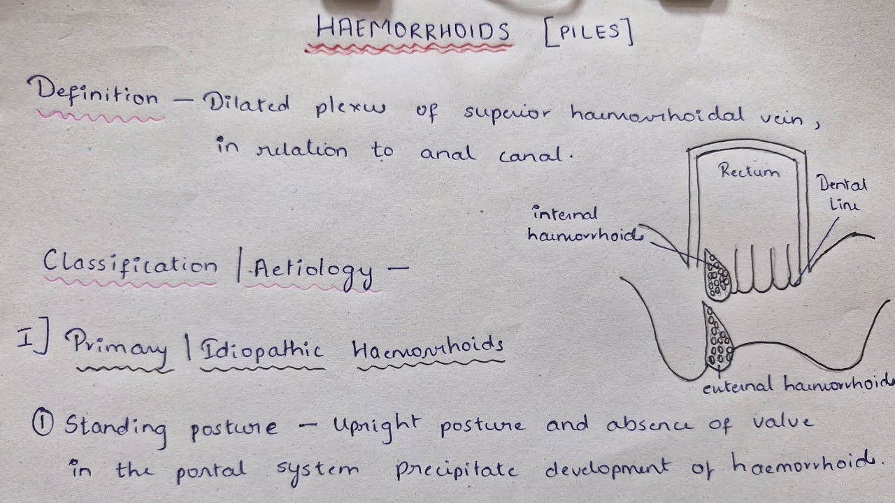 What Are Haemorrhoids ? | Symptoms | Causes | Treatement ...