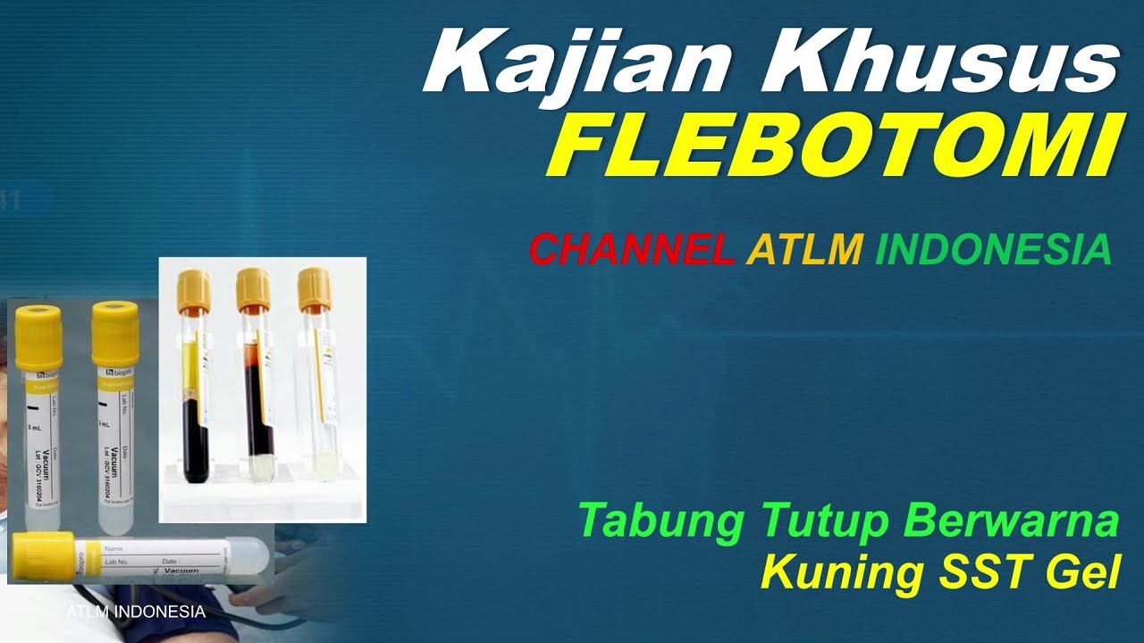 Kajian Khusus Flebotomi: Tabung Vakum Tutup Kuning SST Gel - YouTube