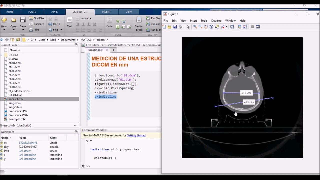 DICOM: MEDICIÓN DE ESTRUCTURAS CON IMDISTLINE EN MATLAB - YouTube