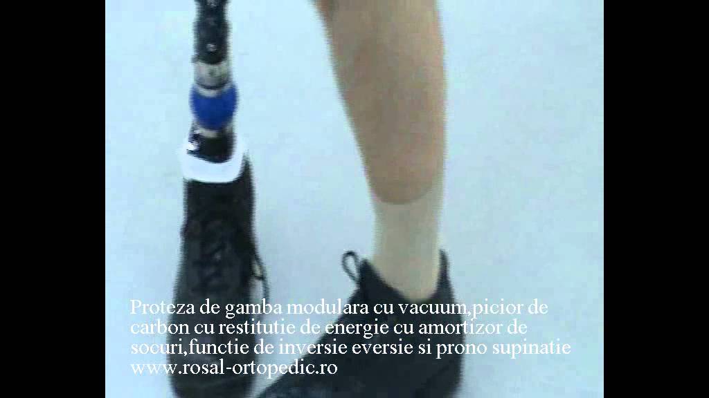 Proteza de gamba modulara, picior de carbon, restitutie de energie si ...