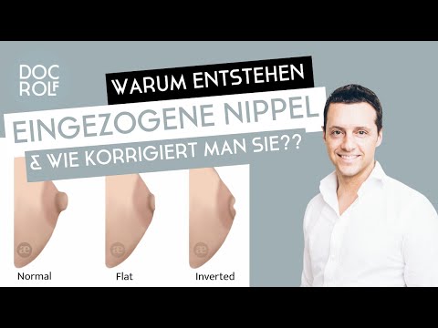 INVERTIERTER NIPPEL, SCHLUPFWARZE – wie korrigiert man sie? Dr. Rolf Bartsch erklärt