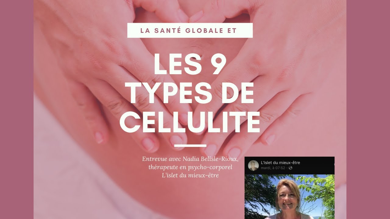 Les 9 types de cellulite dans l'angle de la santé globale - YouTube