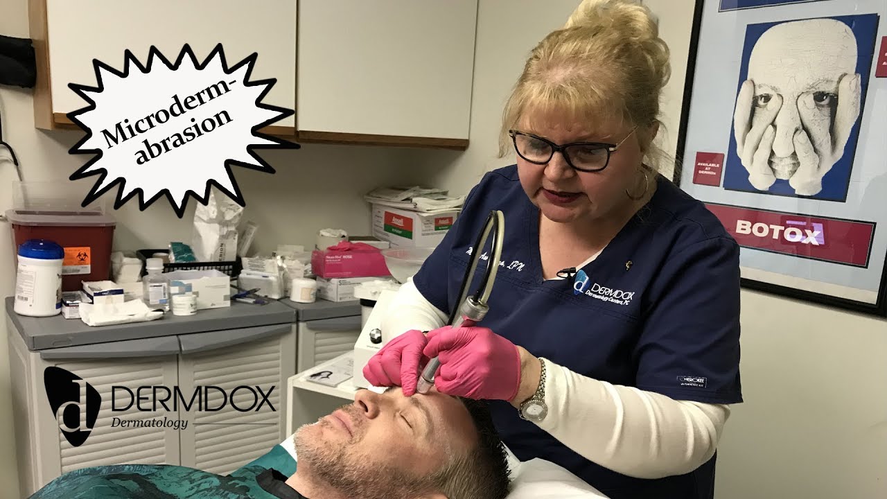 Microdermabrasion - DermDox Dermatology Centers - YouTube