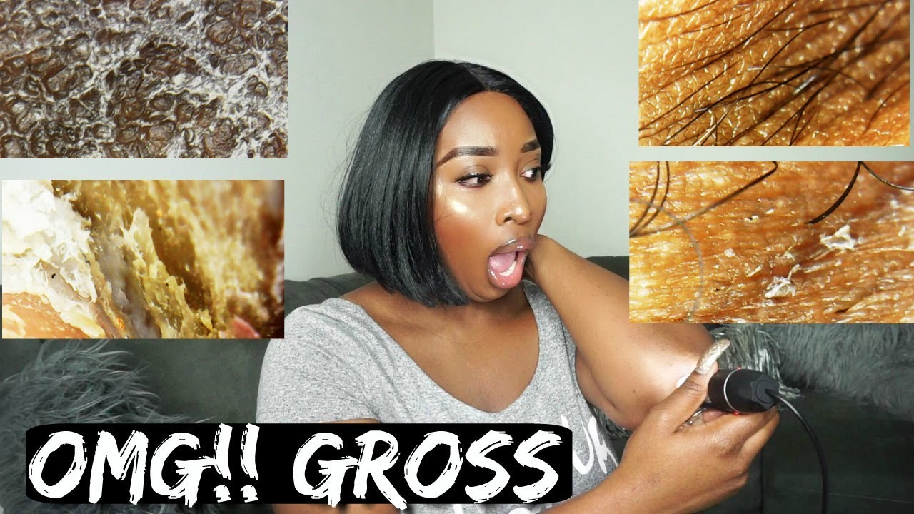 How My Body Parts Look Under A Microscope!! (GROSS) - YouTube