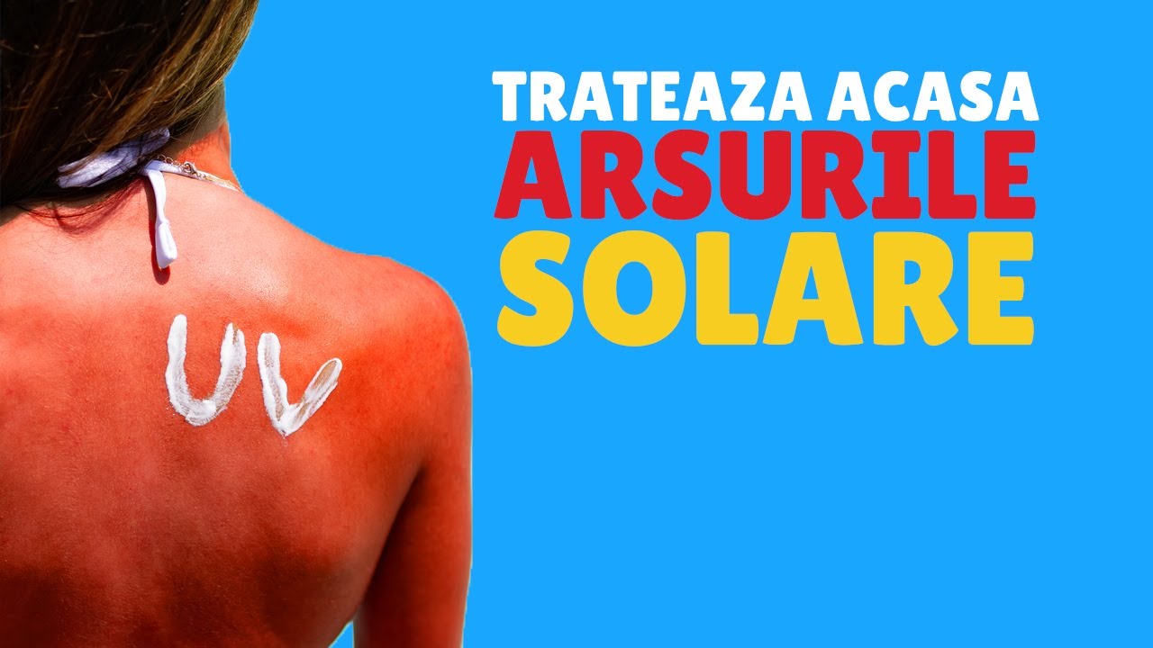 Remedii naturiste pentru arsuri solare 🌞 - YouTube