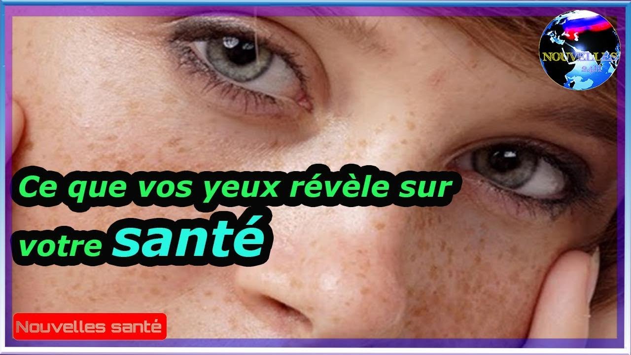 Ce que vos yeux révèle sur votre santé|Nouvelles24h - YouTube