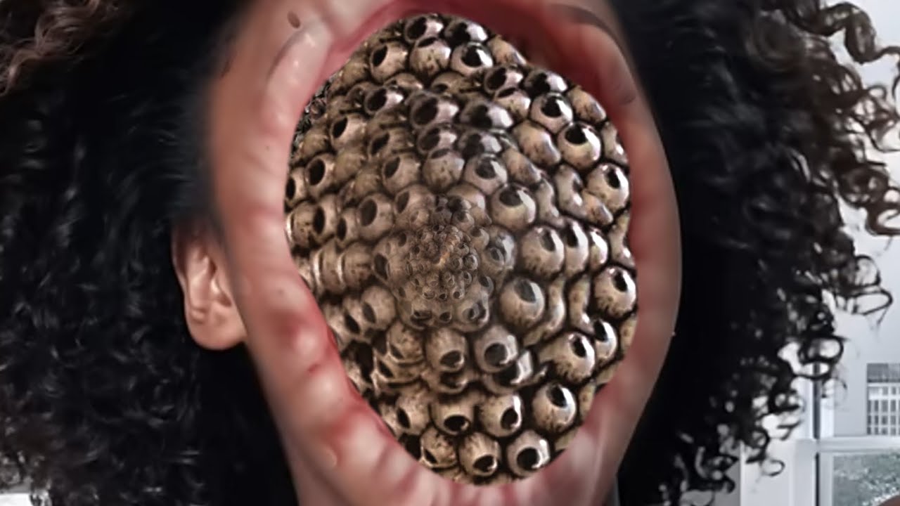 ASMR | Suddenly cleaning face treatment animation | Get rid from ...