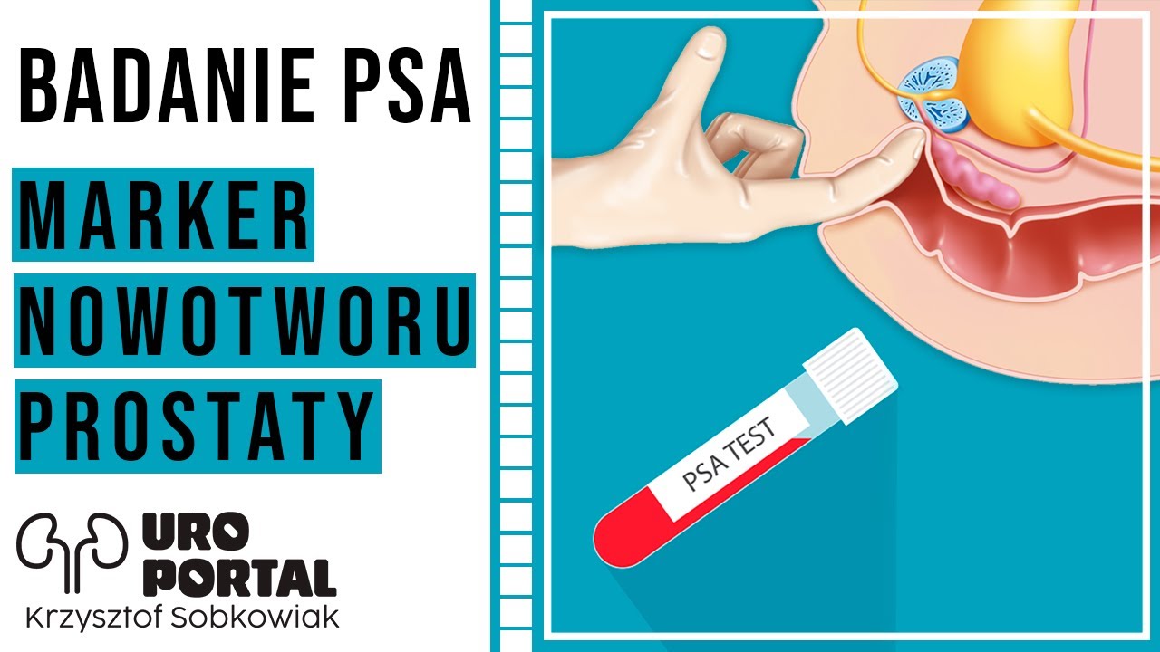 Prostata u mężczyzn - Badanie PSA. Rozrost gruczołu krokowego i rak ...