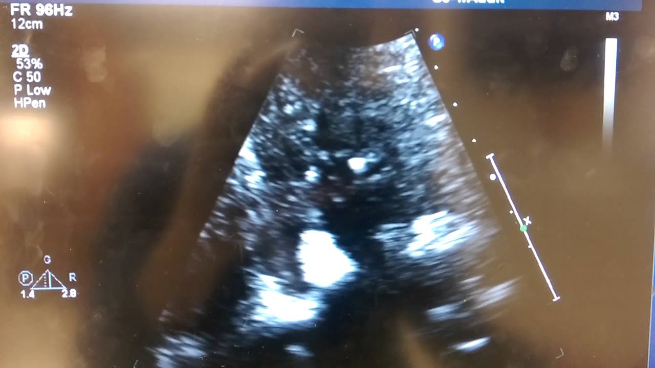 Robert echo case study 2 - YouTube