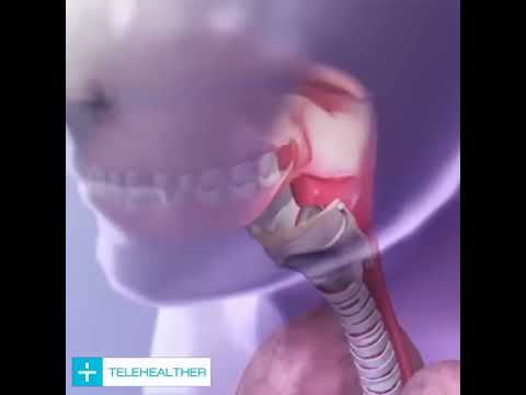 Function of the Epiglottis - YouTube