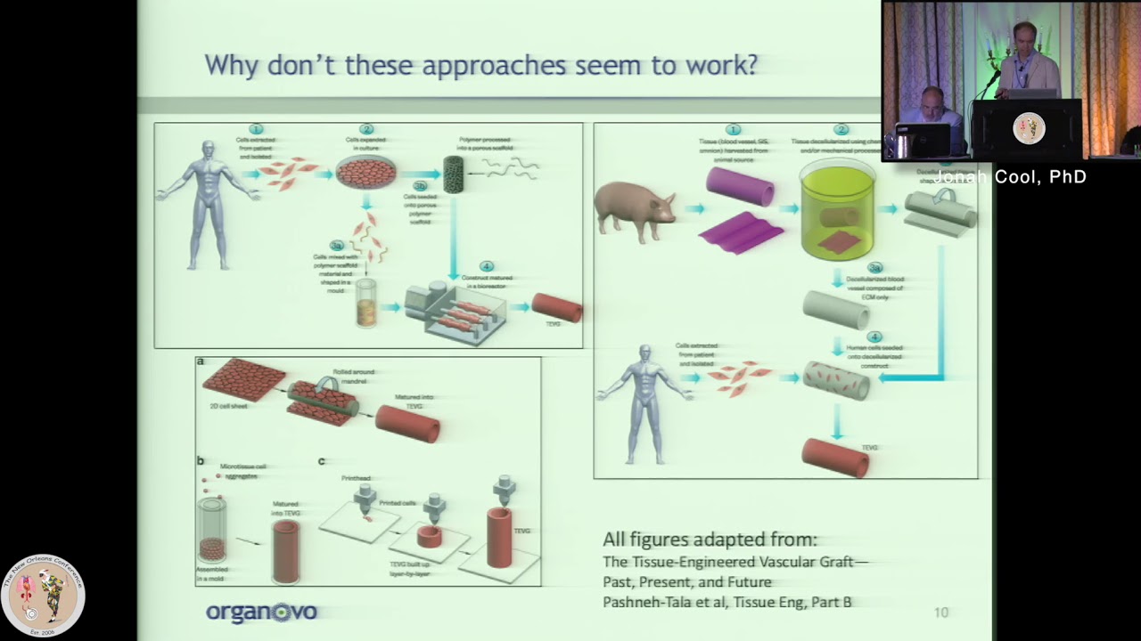 Tissue Engineering and 3D Bioprinting (Jonah Cool, PhD) - YouTube