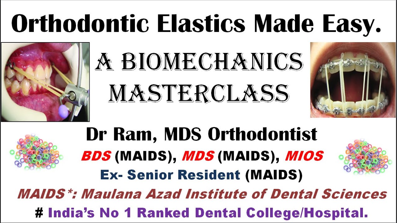 A-Z of Elastics in Orthodontics. Mid-line I Occlusion Settling; Class ...
