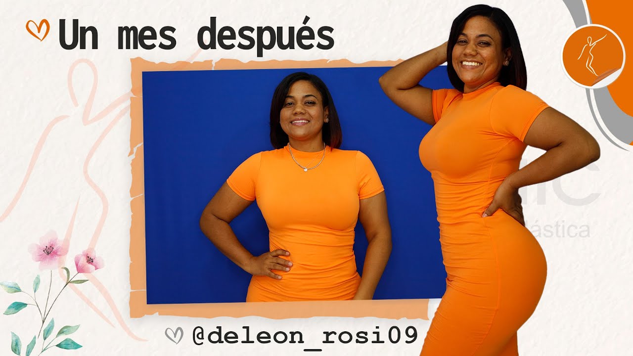 IMECIP CLINIC - ABDOMINOPLASTIA (REGALO DEL DIA DE LAS MADRES) - YouTube