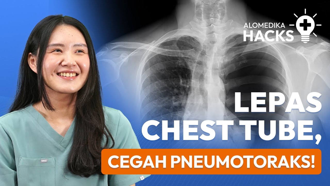 Cara Lepas Chest Tube atau Selang Drain Toraks Pasien! - YouTube