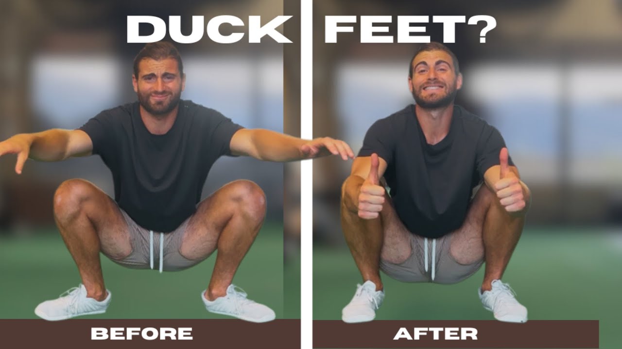 How to Fix Foot Turn Out (Duck Feet) When Squatting or Walking- 5 ...