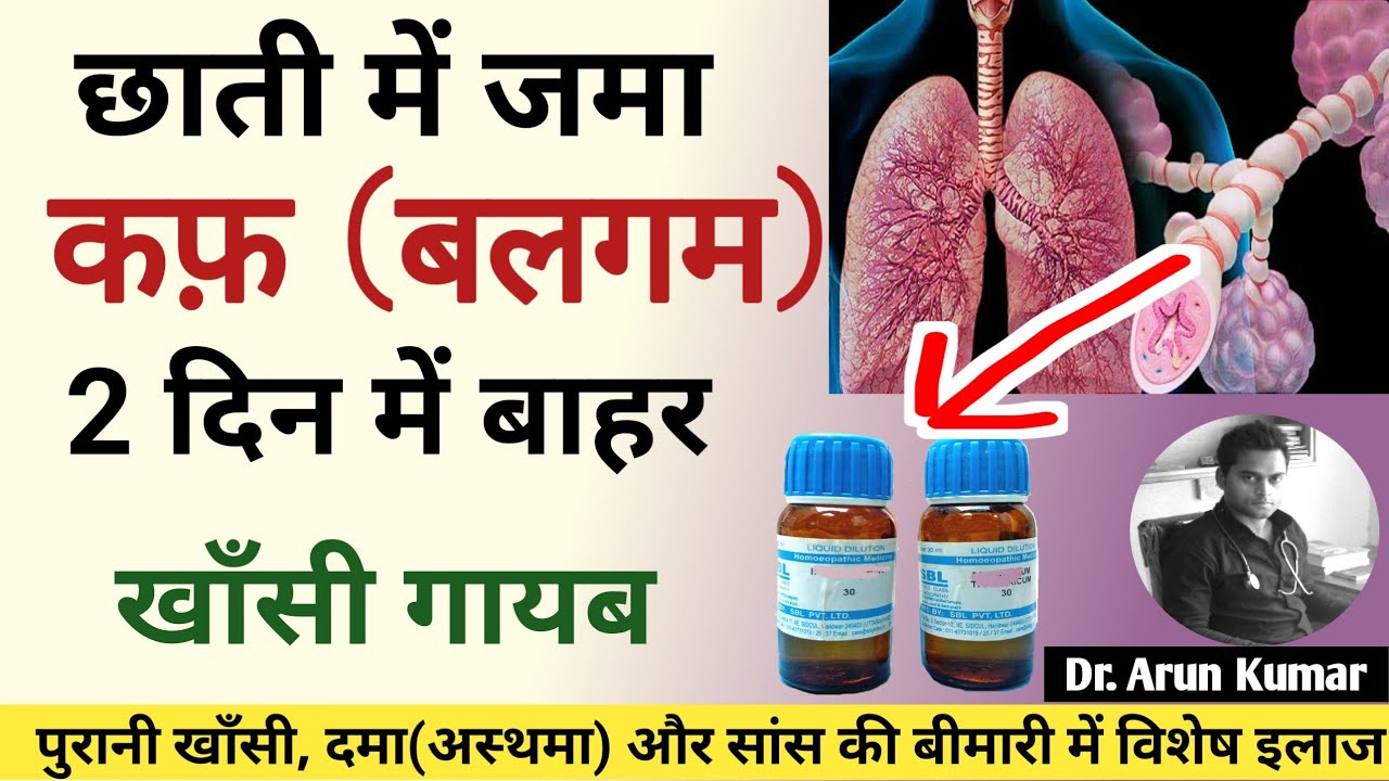 2 दिन में छाती और गले में जमा कफ बाहर||Balgam Nikalne ki Homeopathic ...