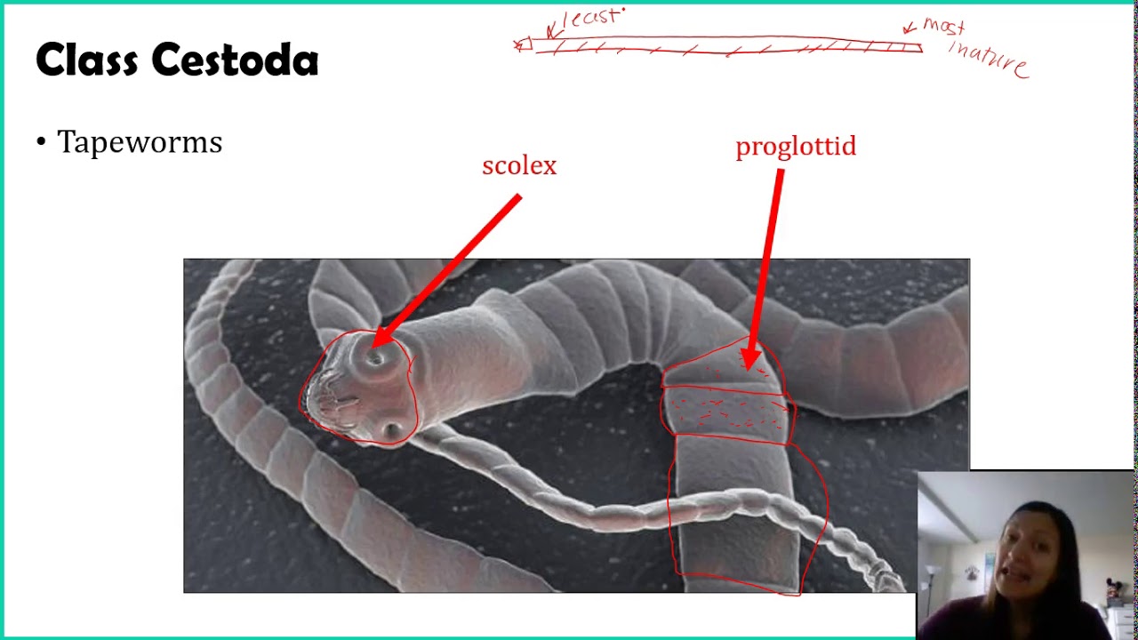 Class Cestoda Tapeworms