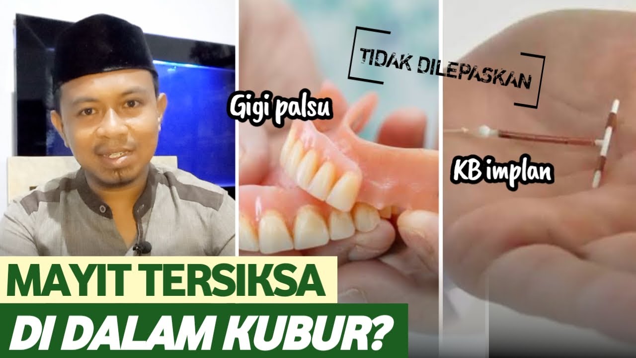 GIGI PALSU, KB IMPLAN, SUSUK TIDAK DILEPASKAN DARI MAYIT SAAT ...