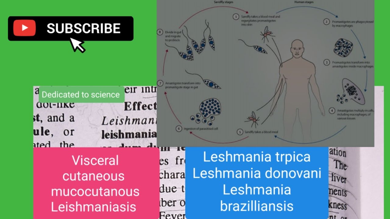 Leishmaniasis types causes and treatment - YouTube