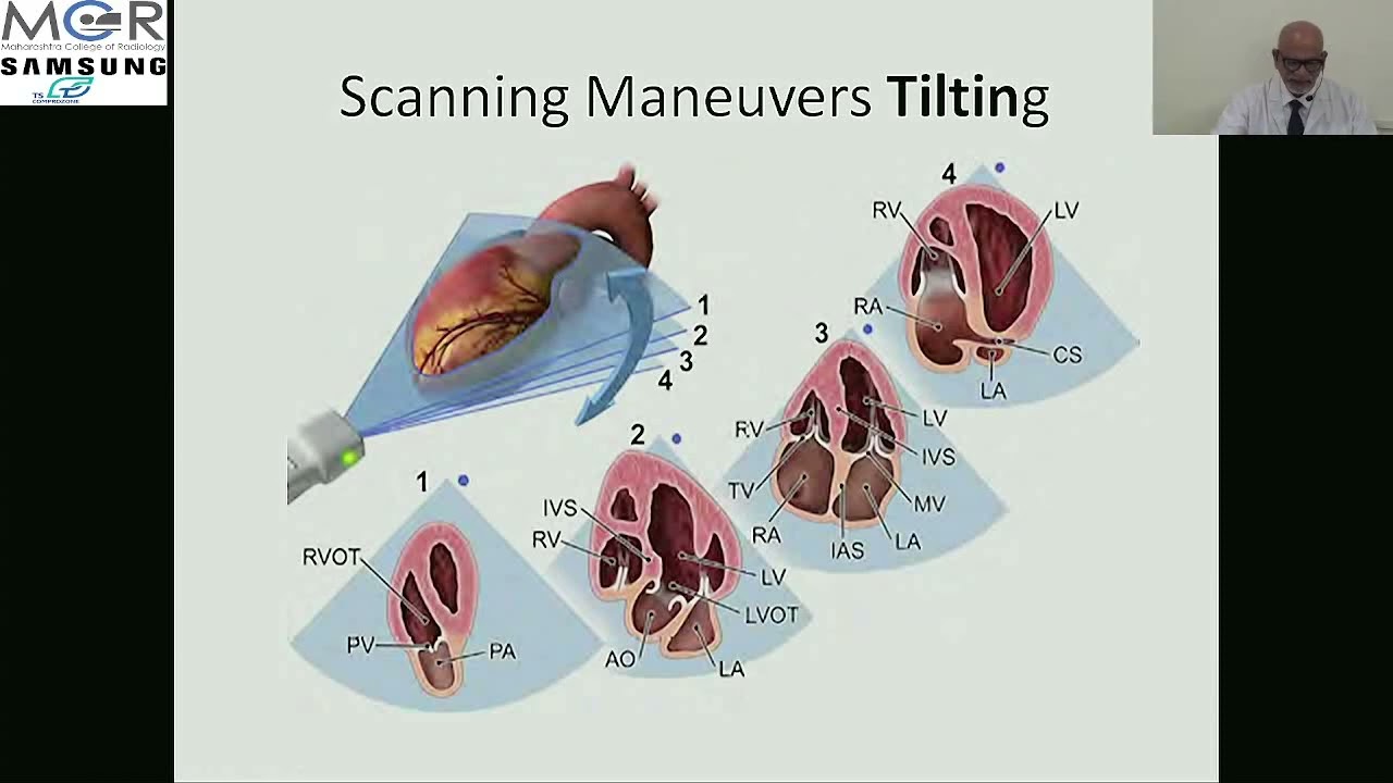 basic adult echocardiography - YouTube