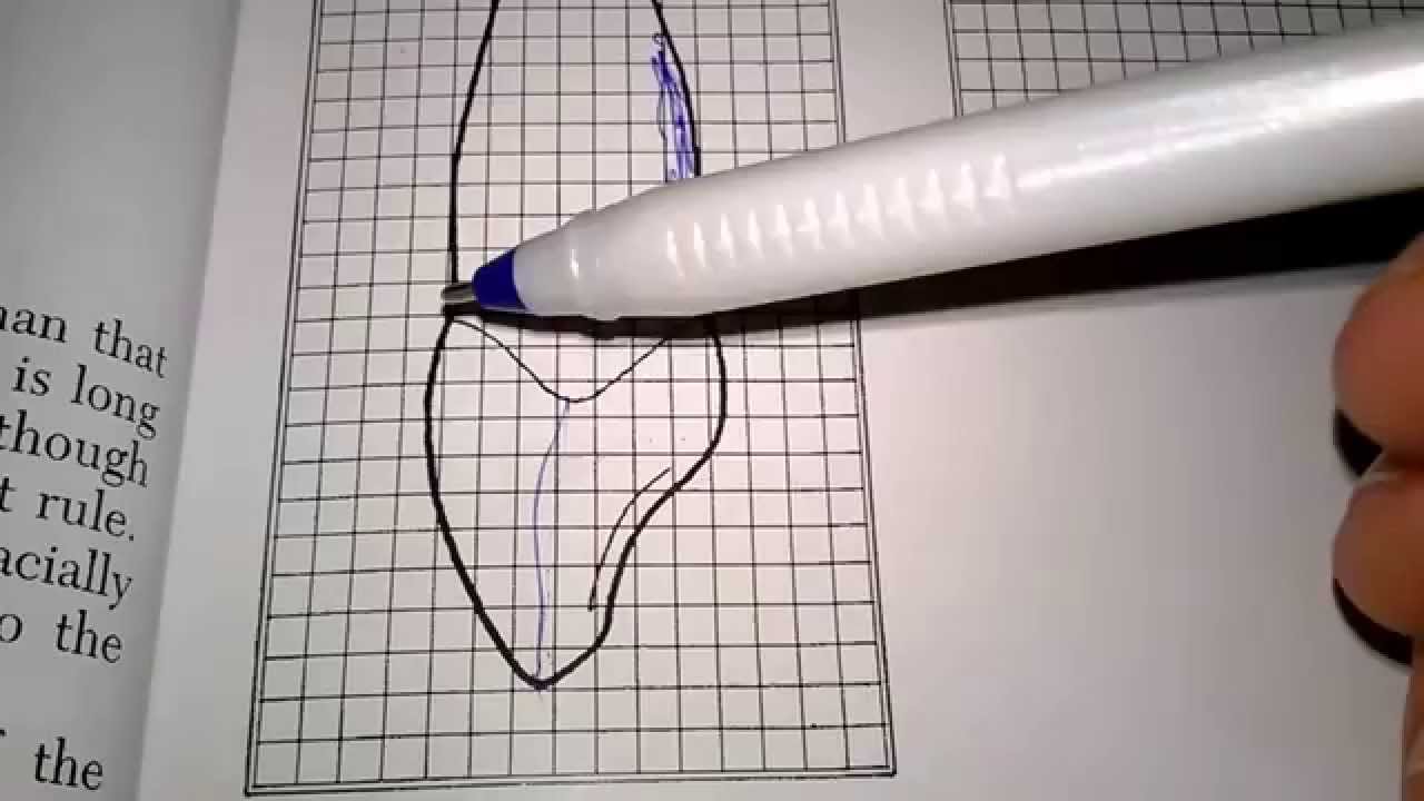 mesial aspect maxillary right canine - YouTube