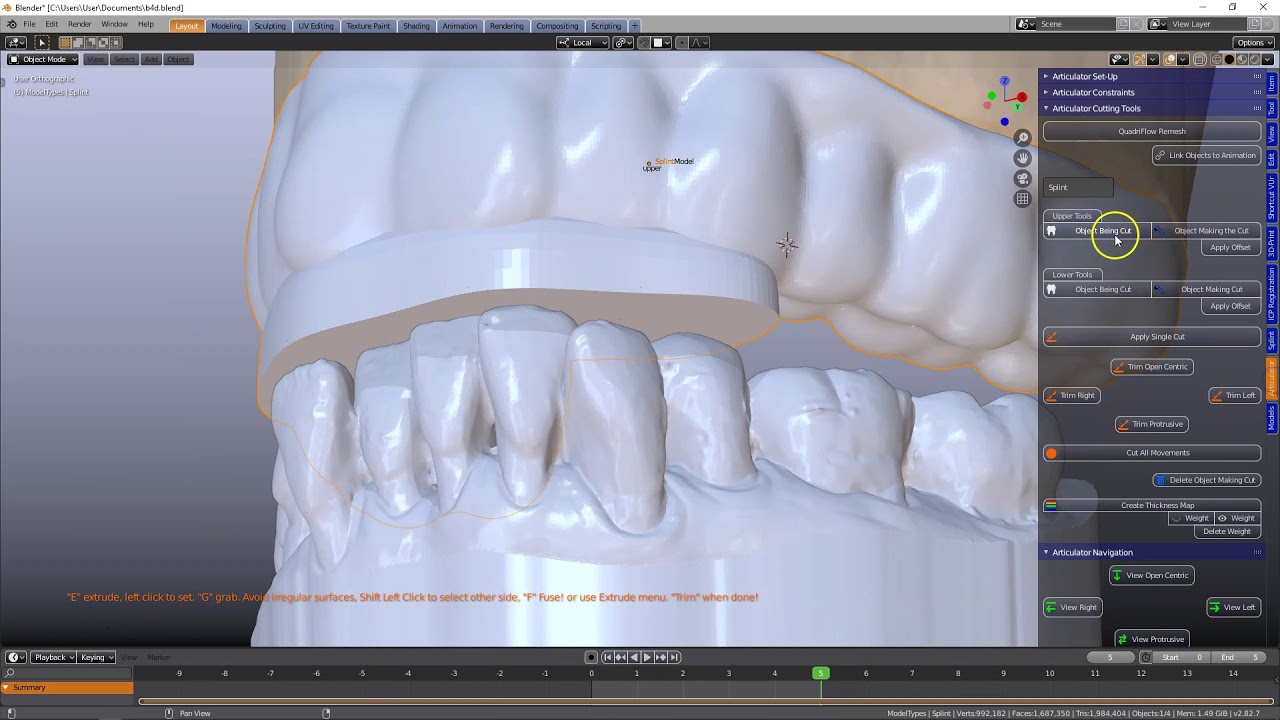 B4D Splint - YouTube