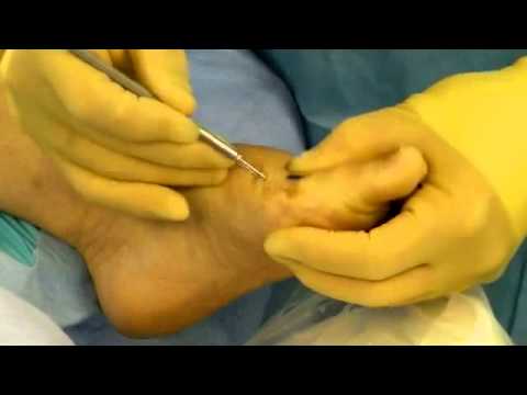 Chevron Akin SD - YouTube