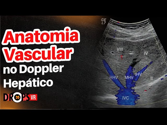 Ultrassonografia Da Arteria Hepatica