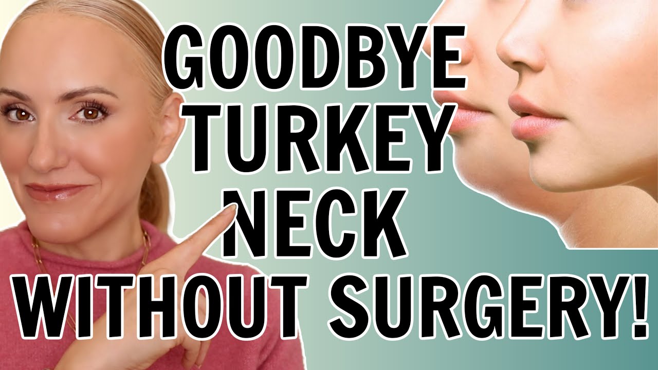 How To Get Rid Of Turkey Neck - NO SURGERY or EXPENSIVE TREATMENTS ...
