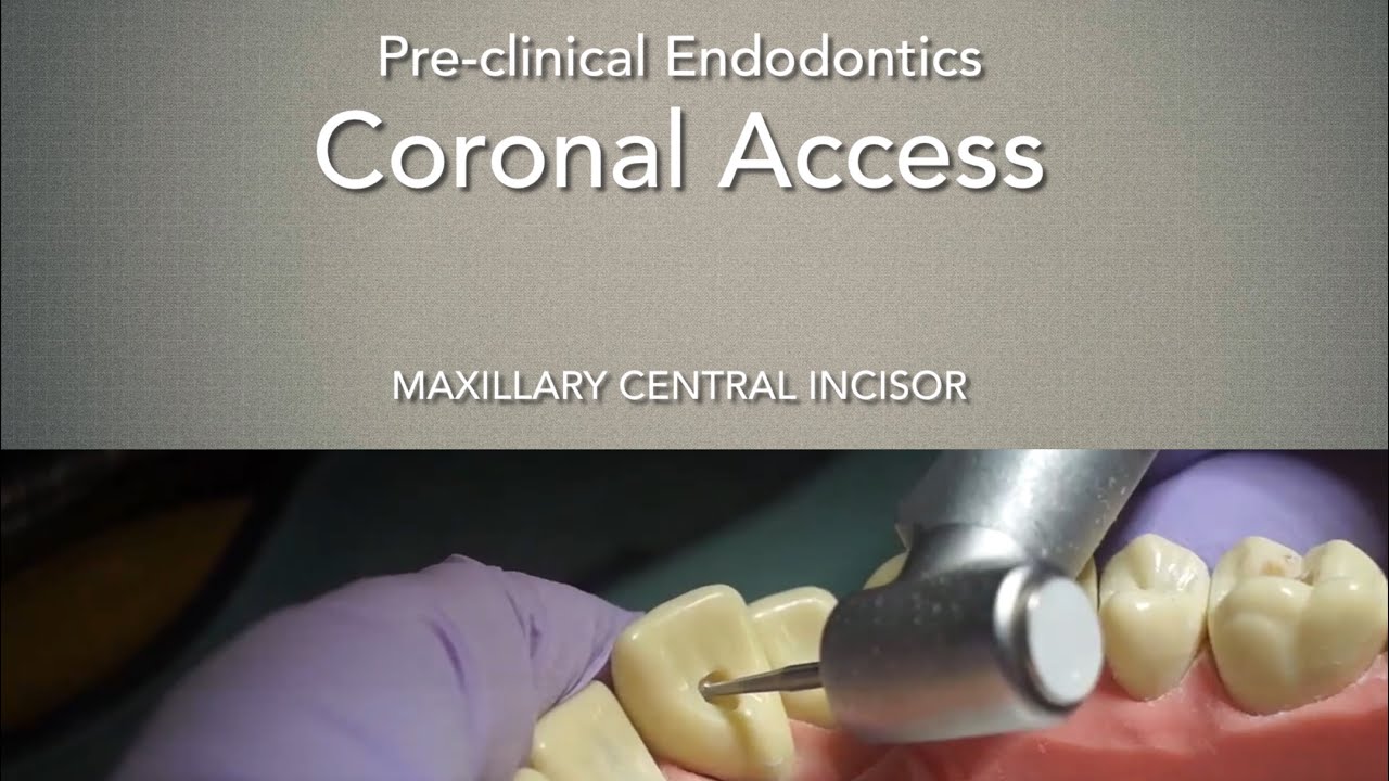 Coronal Access (Maxillary Central Incisor) - YouTube