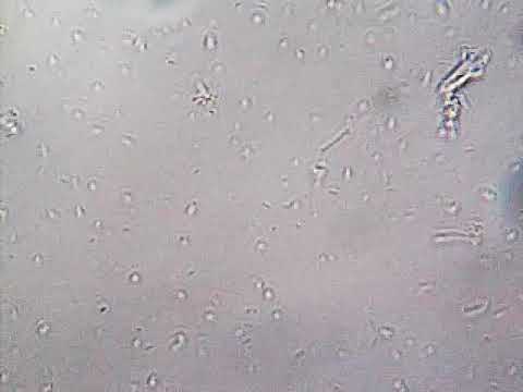 Spiriller i lysmikroskop - del 2 - YouTube