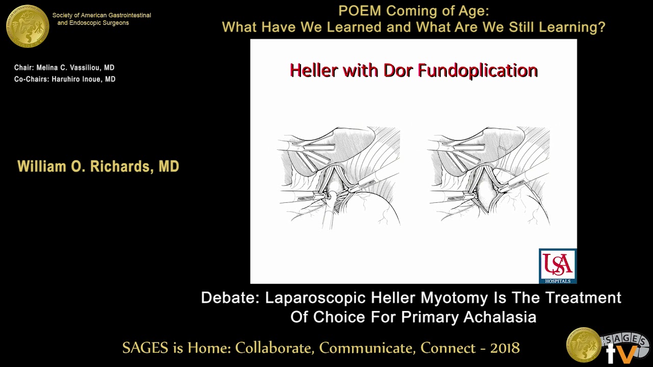 Laparoscopic Heller myotomy is the treatment of choice for primary ...
