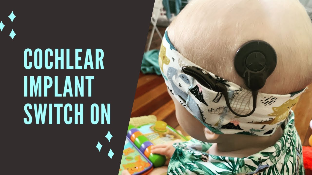 Cochlear Implant Activation | 10 month old baby - YouTube