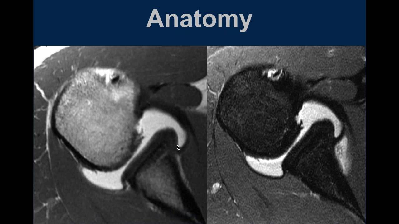 Shoulder | Technical Considerations - YouTube