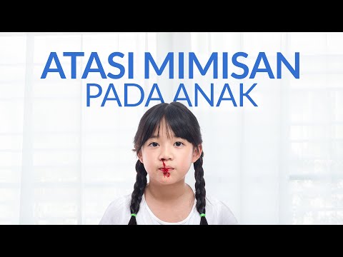 Ketahui Penyebab Mimisan pada Anak dan Cara Menanganinya