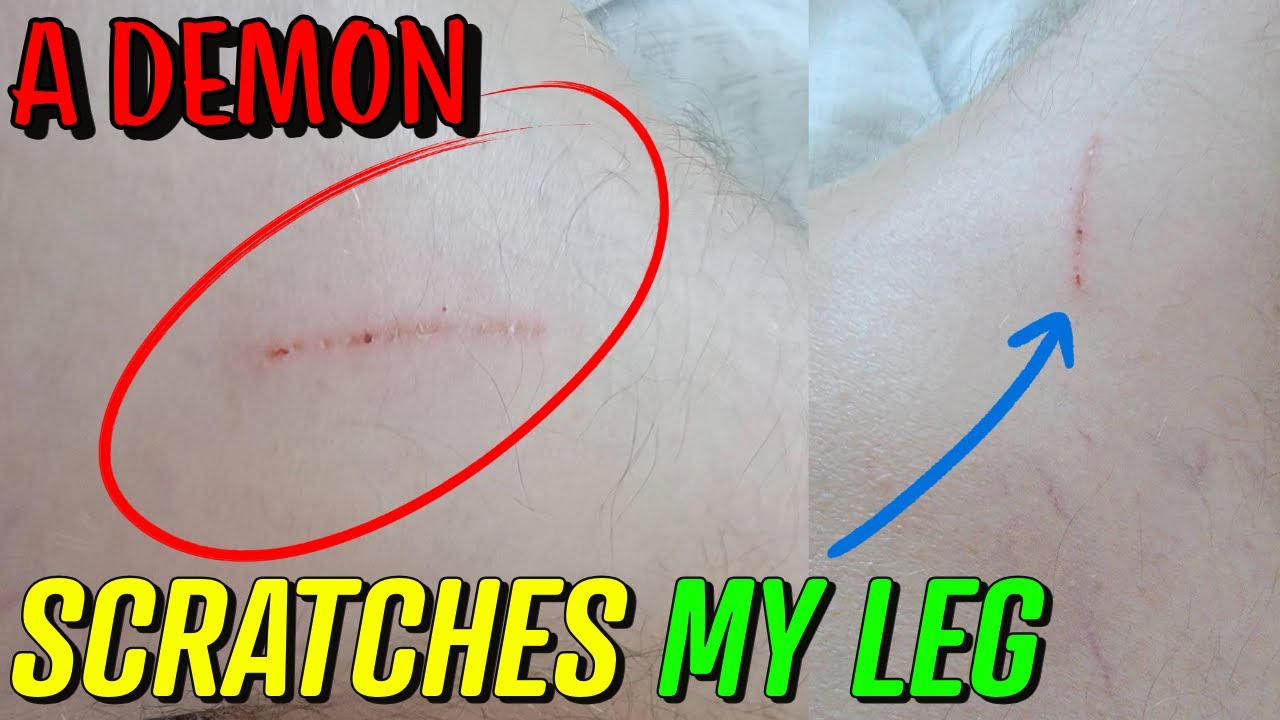 A Demon Scratched My Knee In Broad Daylight - YouTube