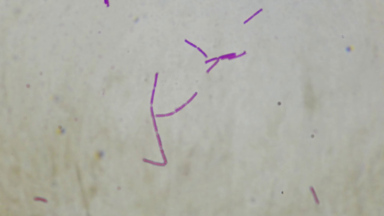 Bacillus anthracis causes anthrax - YouTube