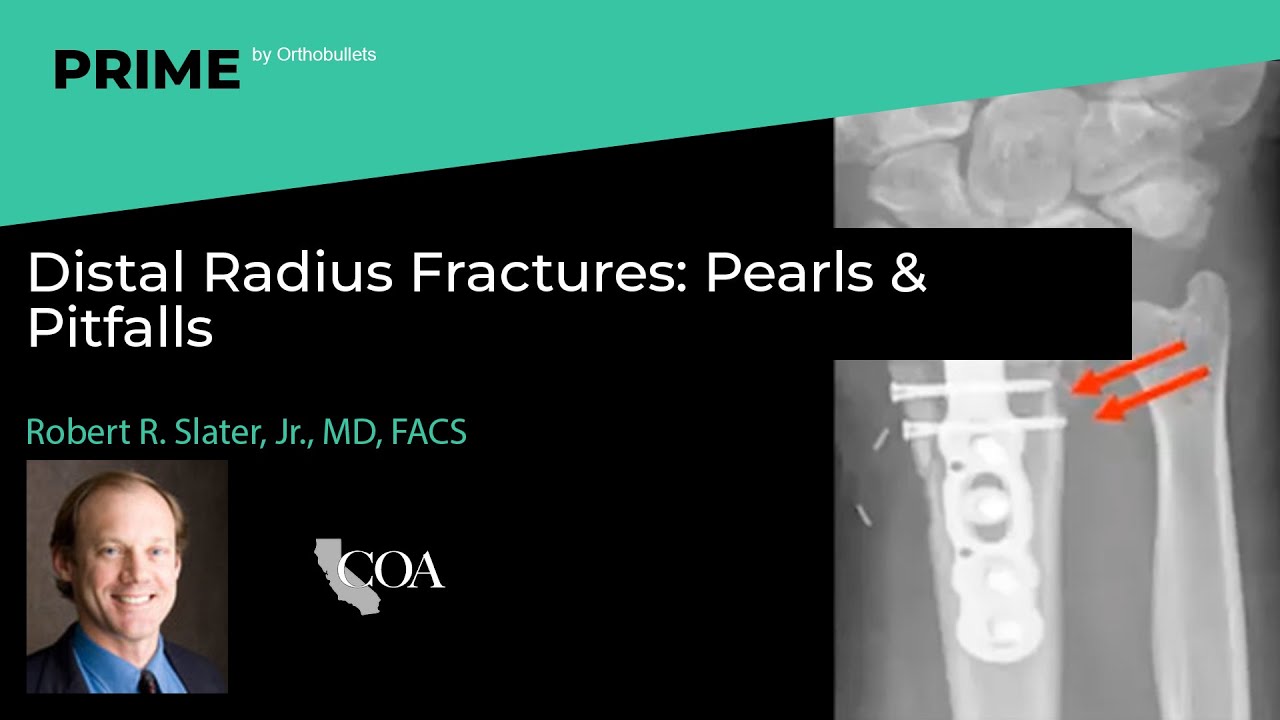 Distal Radius Fractures: Pearls & Pitfalls - Robert R. Slater, Jr., MD ...
