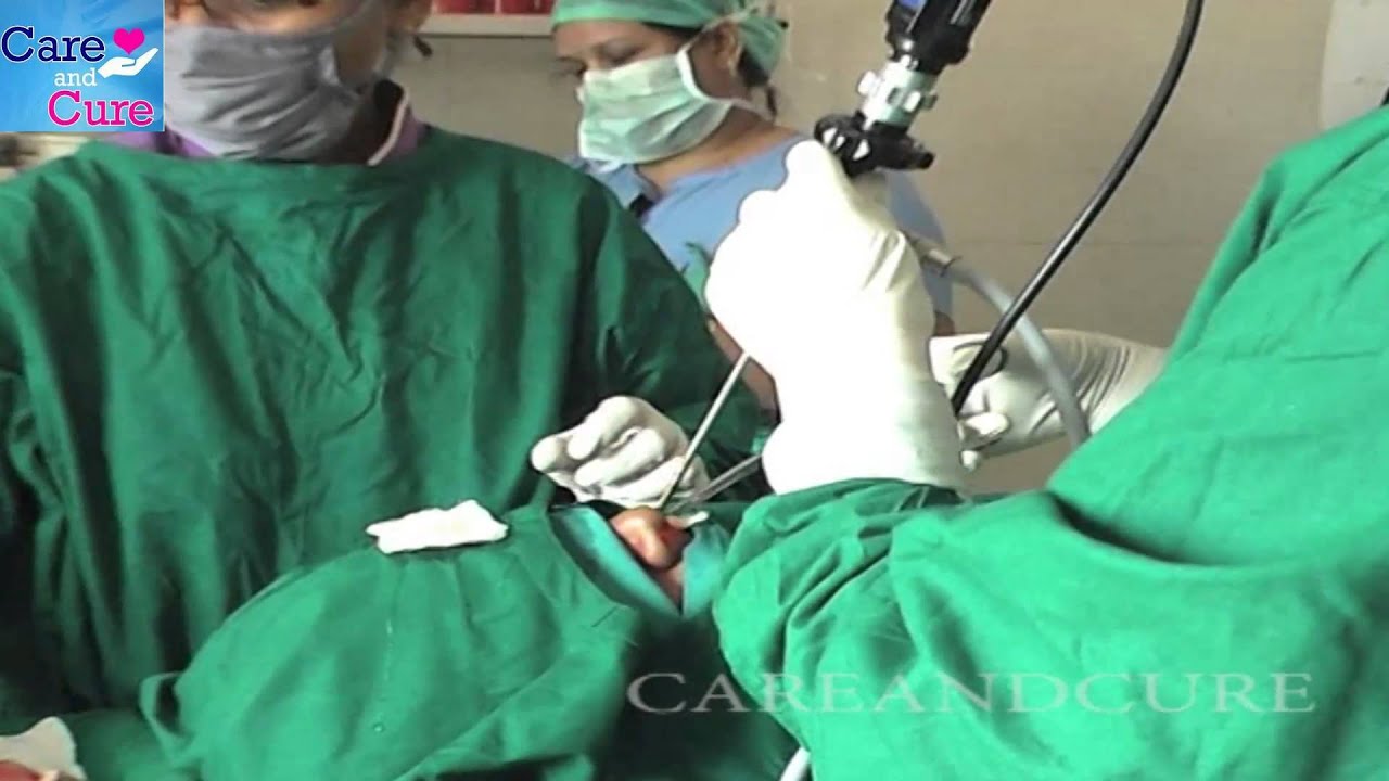 Live Sinus Surgery | Sinus Surgery | Endoscopic Sinus Surgery - YouTube