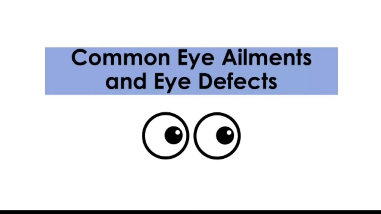 Common Eye Ailments and Eye Defects I Proper Care for the Eyes I ...