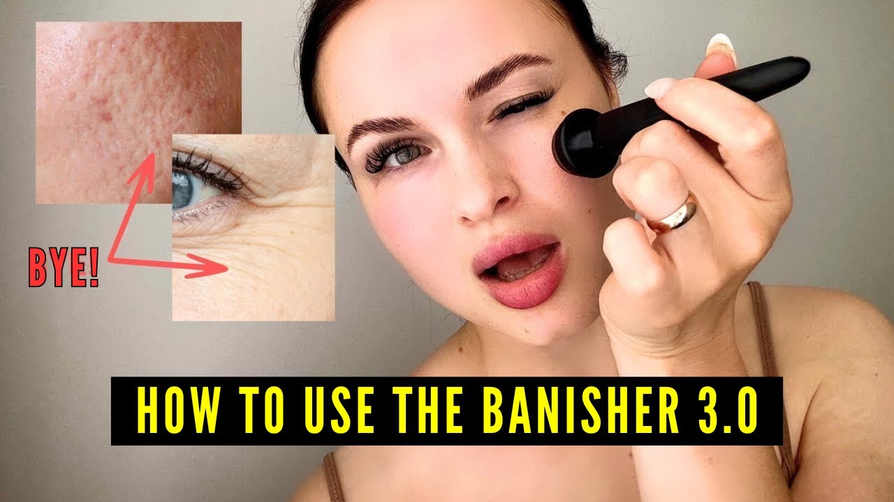 How To Use The Banish Kit 3.0 (STEP-BY-STEP) - YouTube