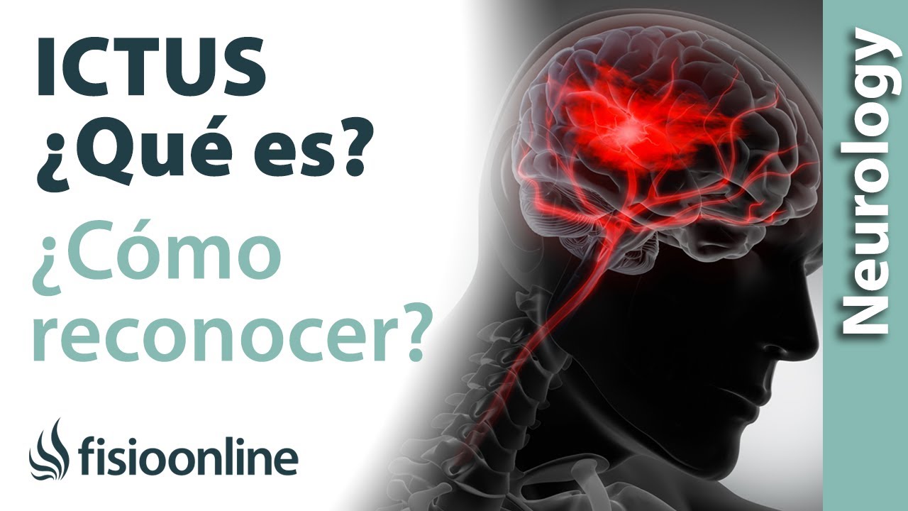 QUÉ ES un ICTUS y cómo reconocerlo para tratarlo - YouTube
