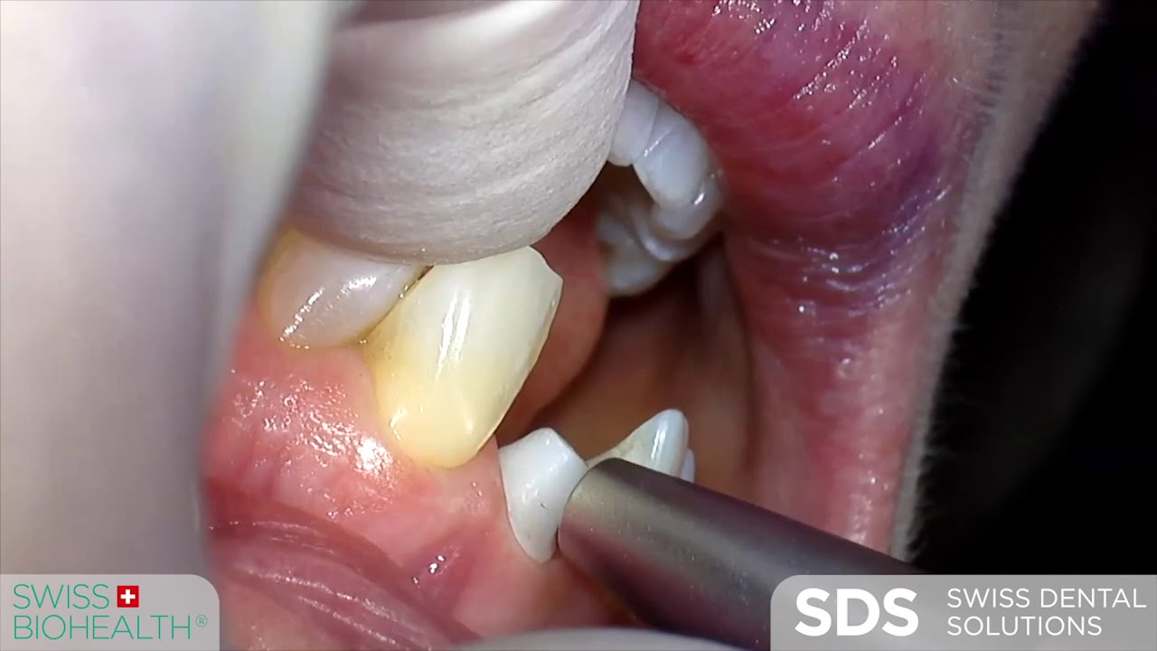 Videothek - SDS SWISS DENTAL SOLUTIONS
