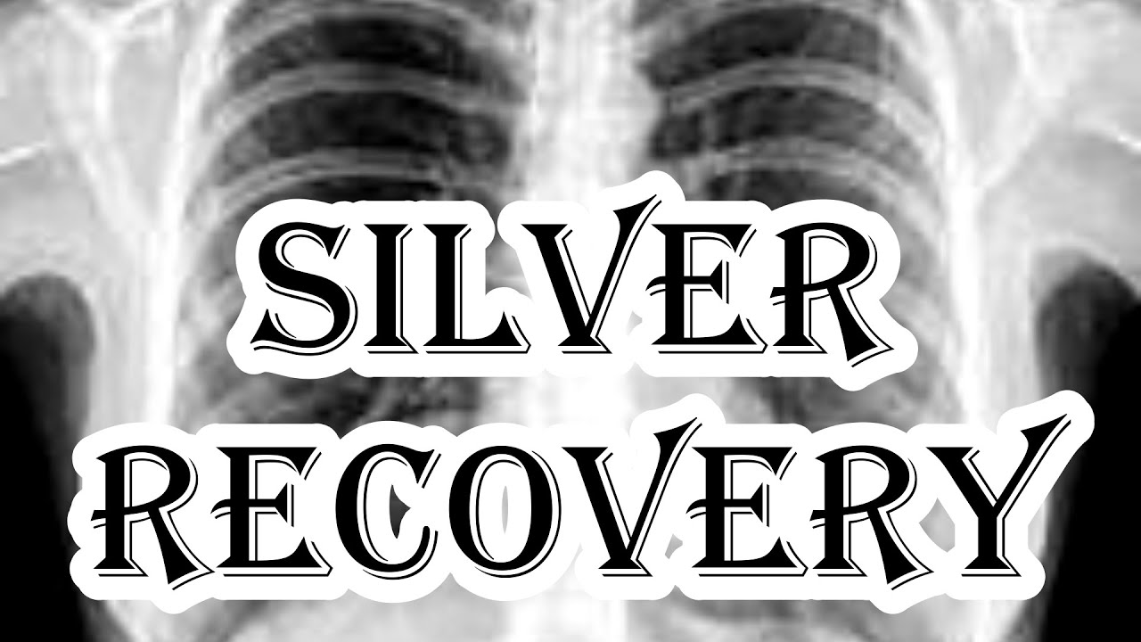 Silver Recovery Secrets: X-ray and Ultrasound Film Techniques Revealed ...