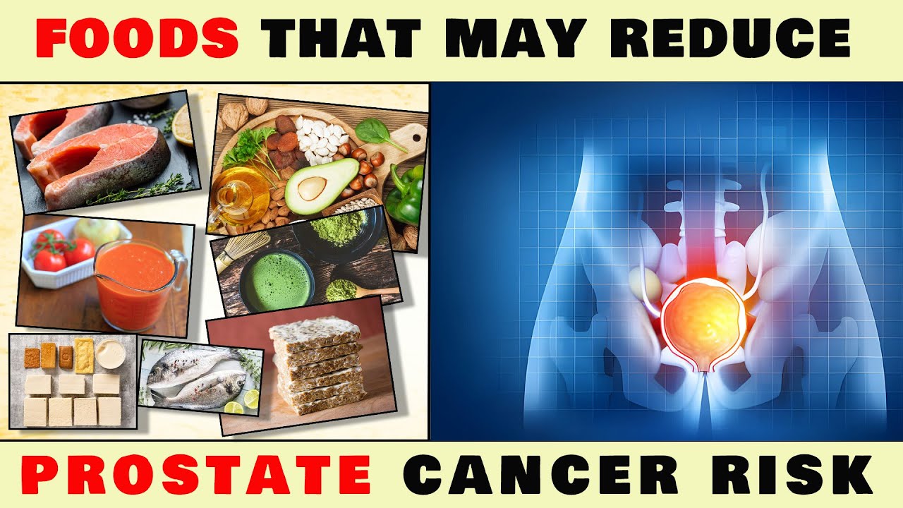 Secret Foods That May Reduce Prostate Cancer Risk | Health and Well ...