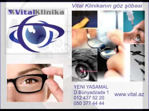 goz hekimi